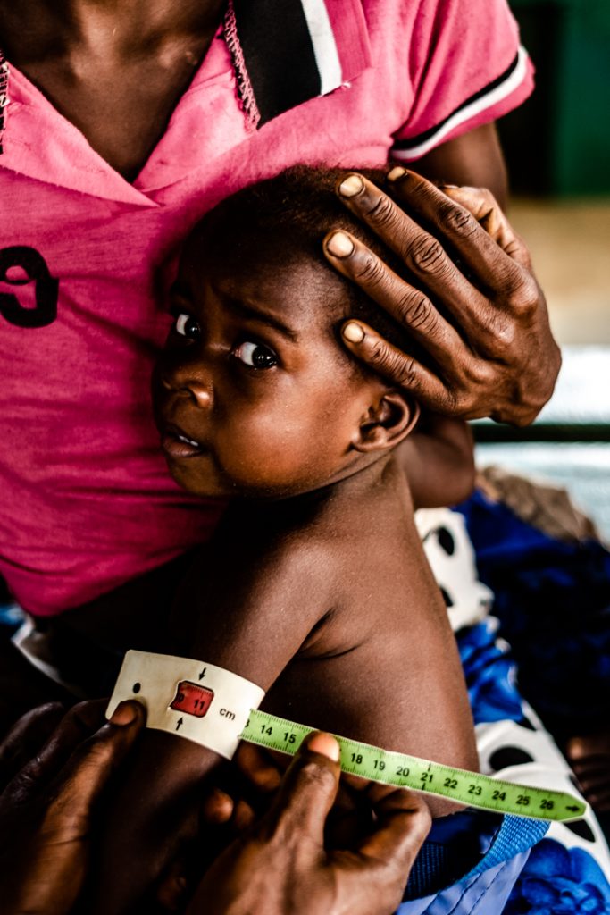 MUAC Tape • MAGNA Hospital